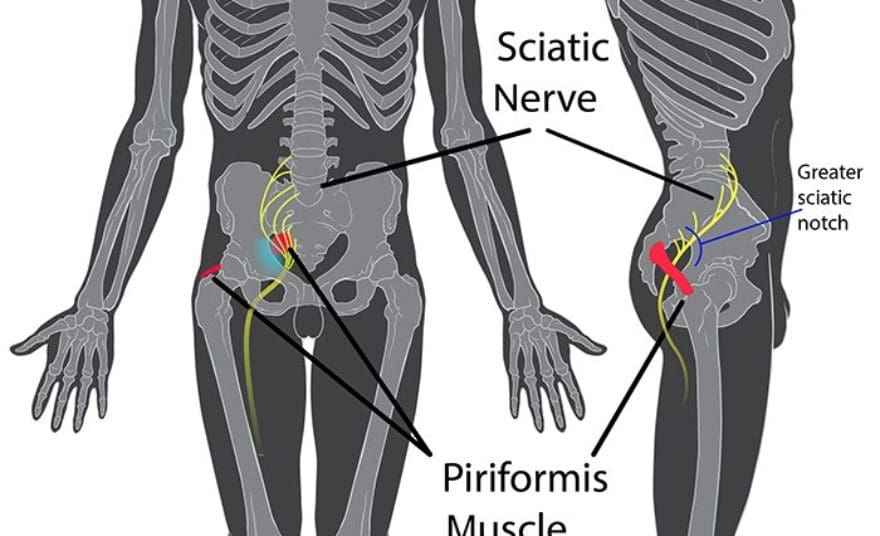 sciatic nerve branches flowchart