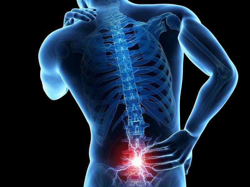Lumbar Disc Nomenclature: Version 2.0 - El Paso, TX Doctor Of Chiropractic